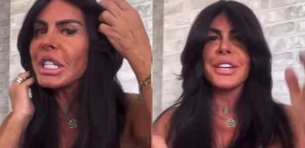 Gretchen: Cantora mostra vídeo com nova harmonização facial