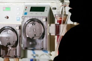 Hospital do Rio faz 1º autotransplante renal - 04/05/2016 - UOL Notícias